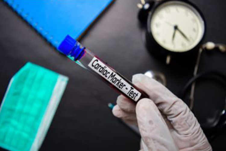 Cardiac Markers – Oak Diagnostic Center